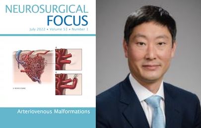 AVMs the Subject of Neurosurgical Focus July Issue | UW Department of ...